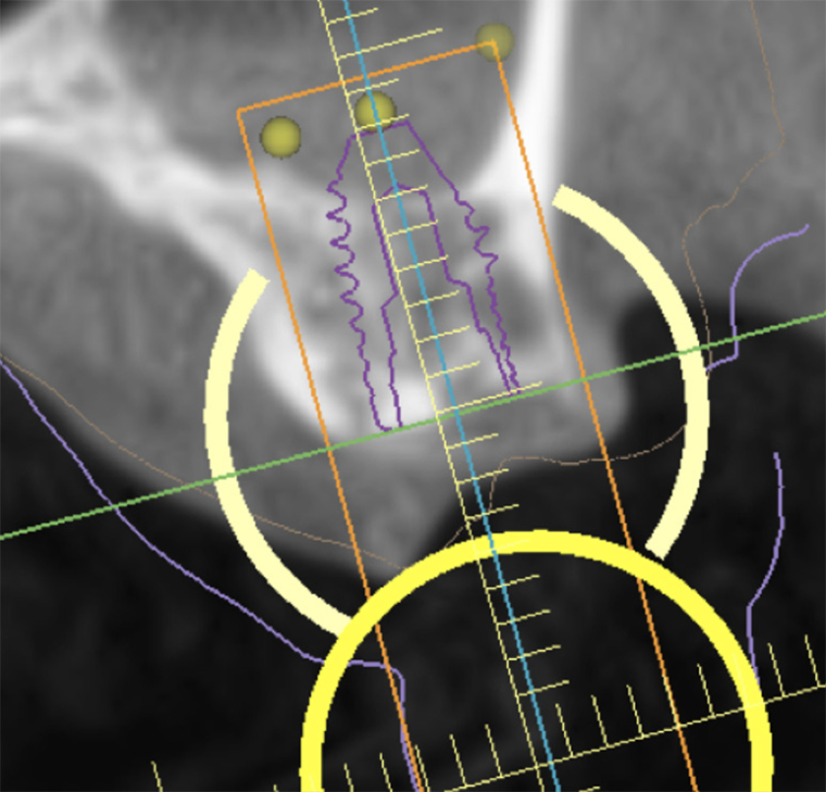 Diagnóstico 3D (TAC) - Clínica Dental Domínguez