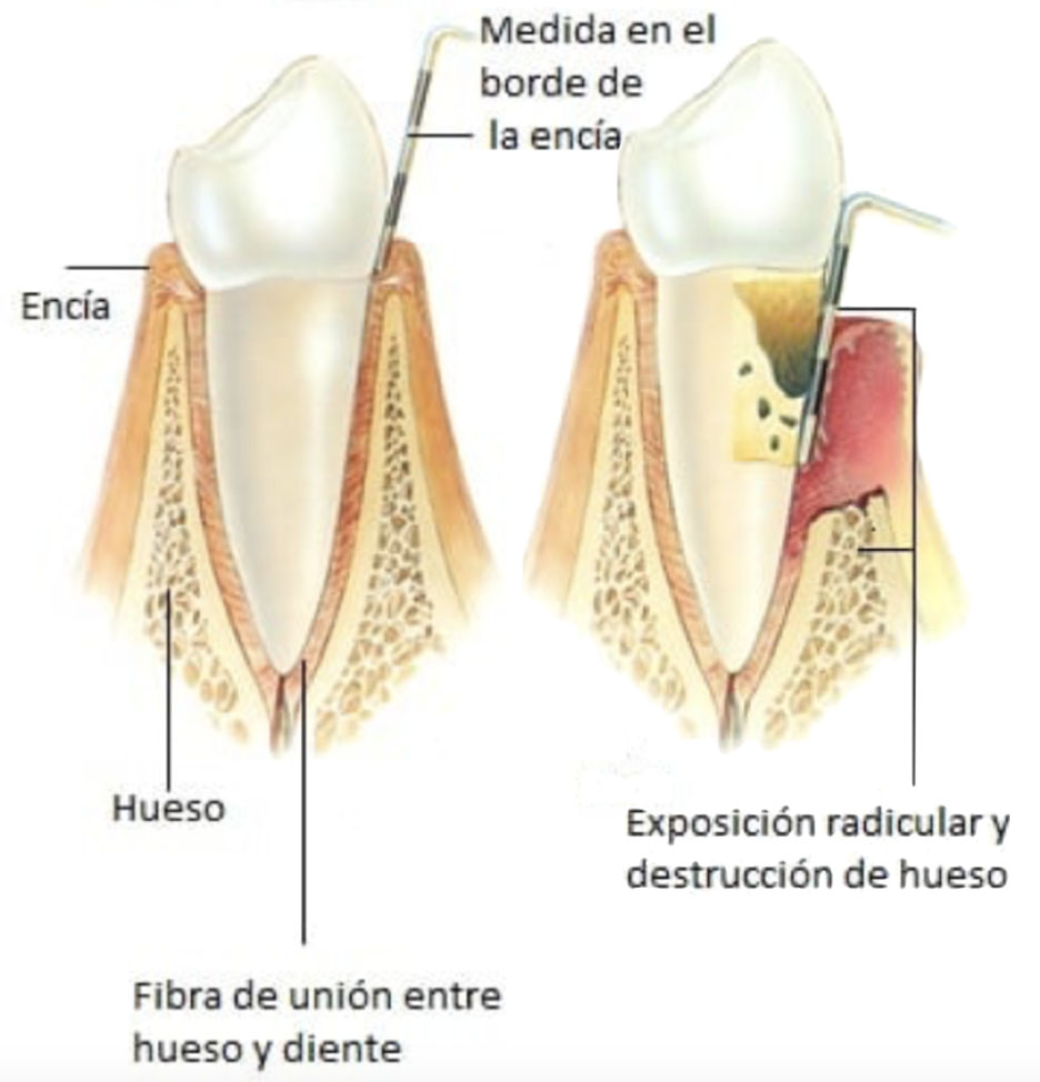 Periodoncia - Clínica Dental Domínguez