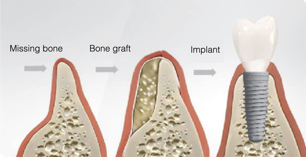 Surgery - Clínica Dental Domínguez